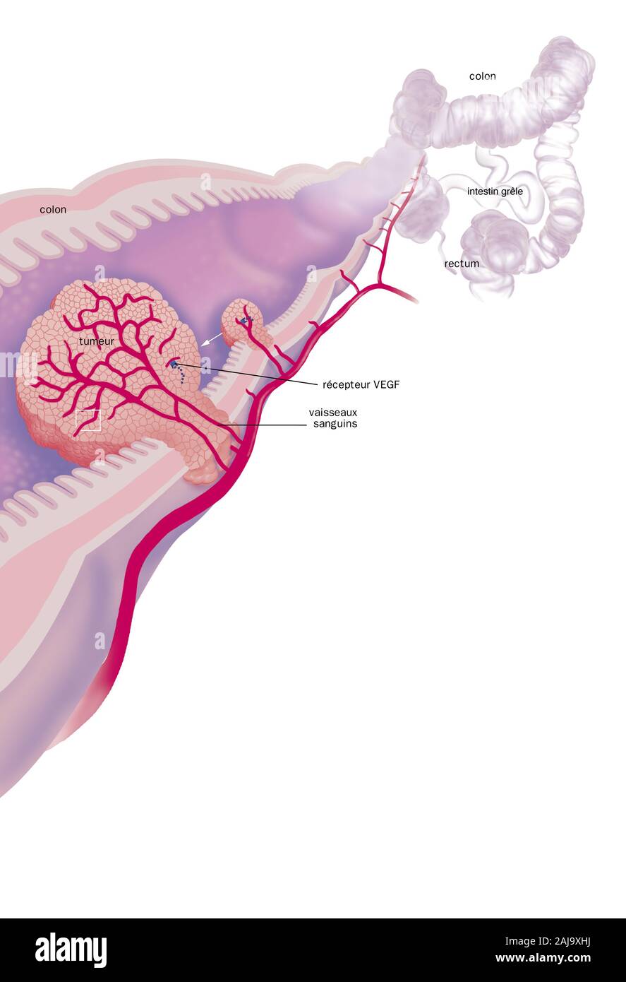 Colorectal Cancer High Resolution Stock Photography and Images - Alamy