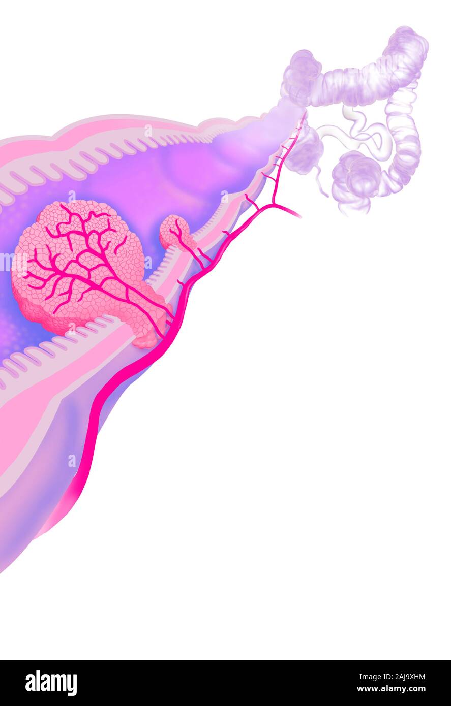 Colon cancer cell hi-res stock photography and images - Alamy