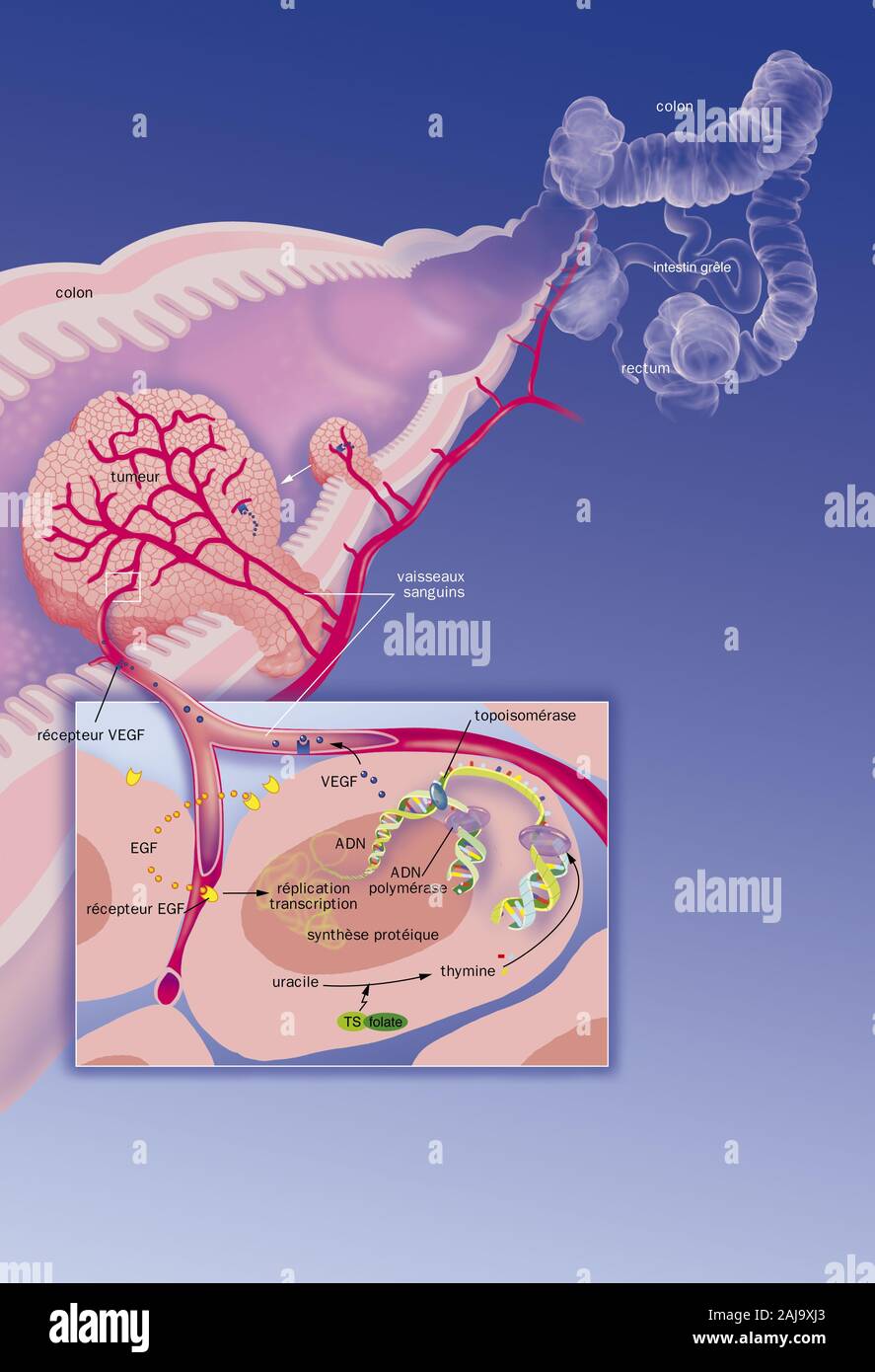 Colorectal Cancer High Resolution Stock Photography and Images - Alamy