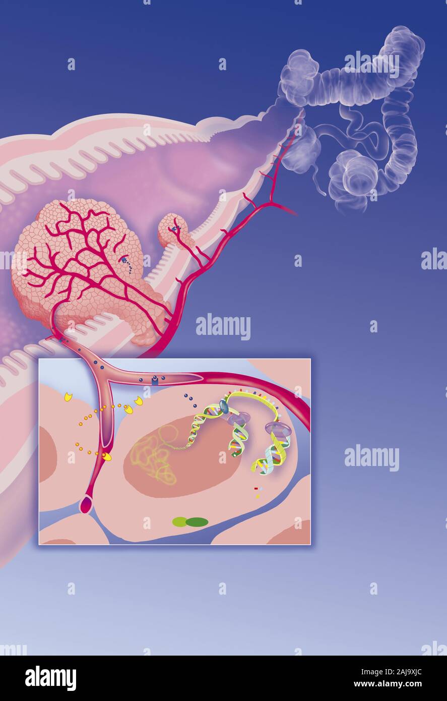 Rectal cancer cell hi-res stock photography and images - Alamy