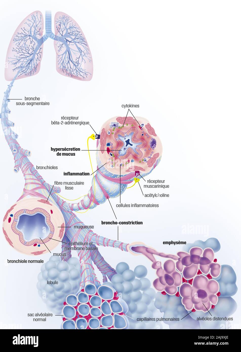 Copd Lungs High Resolution Stock Photography and Images - Alamy