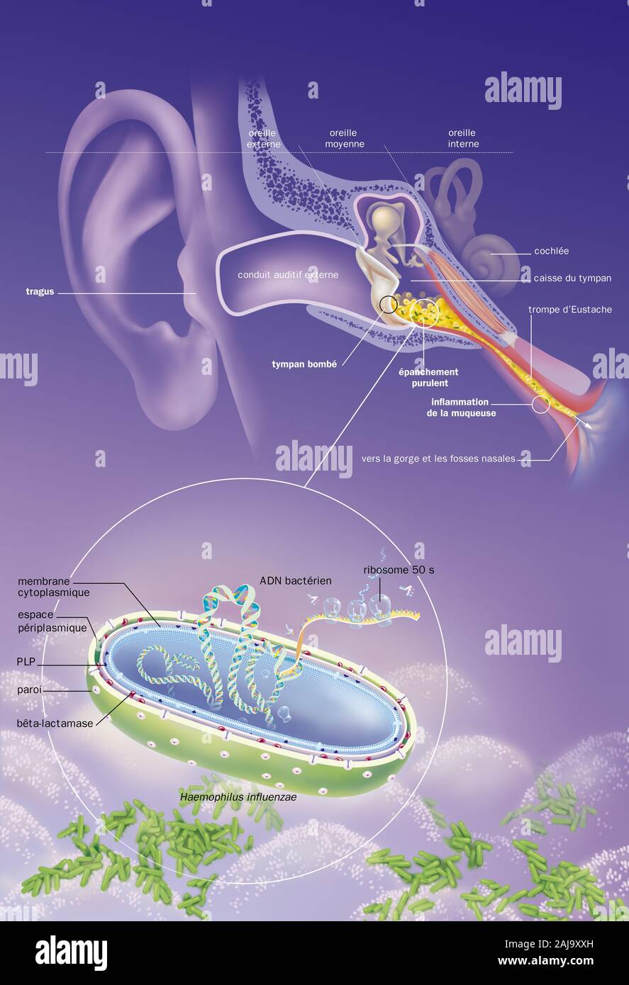 Otitis media eardrum hi-res stock photography and images - Alamy