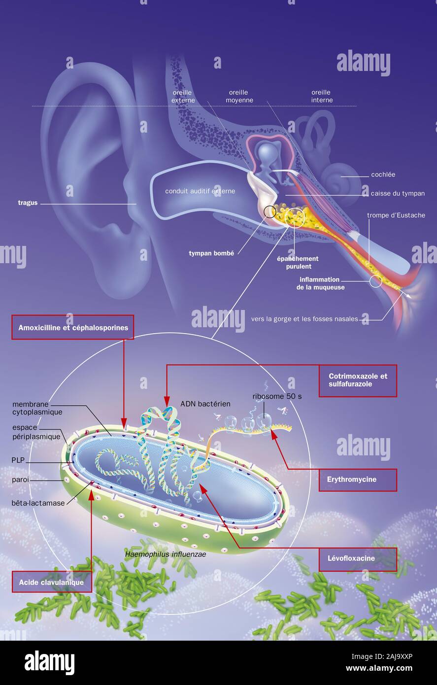 Otitis media eardrum hi-res stock photography and images - Alamy