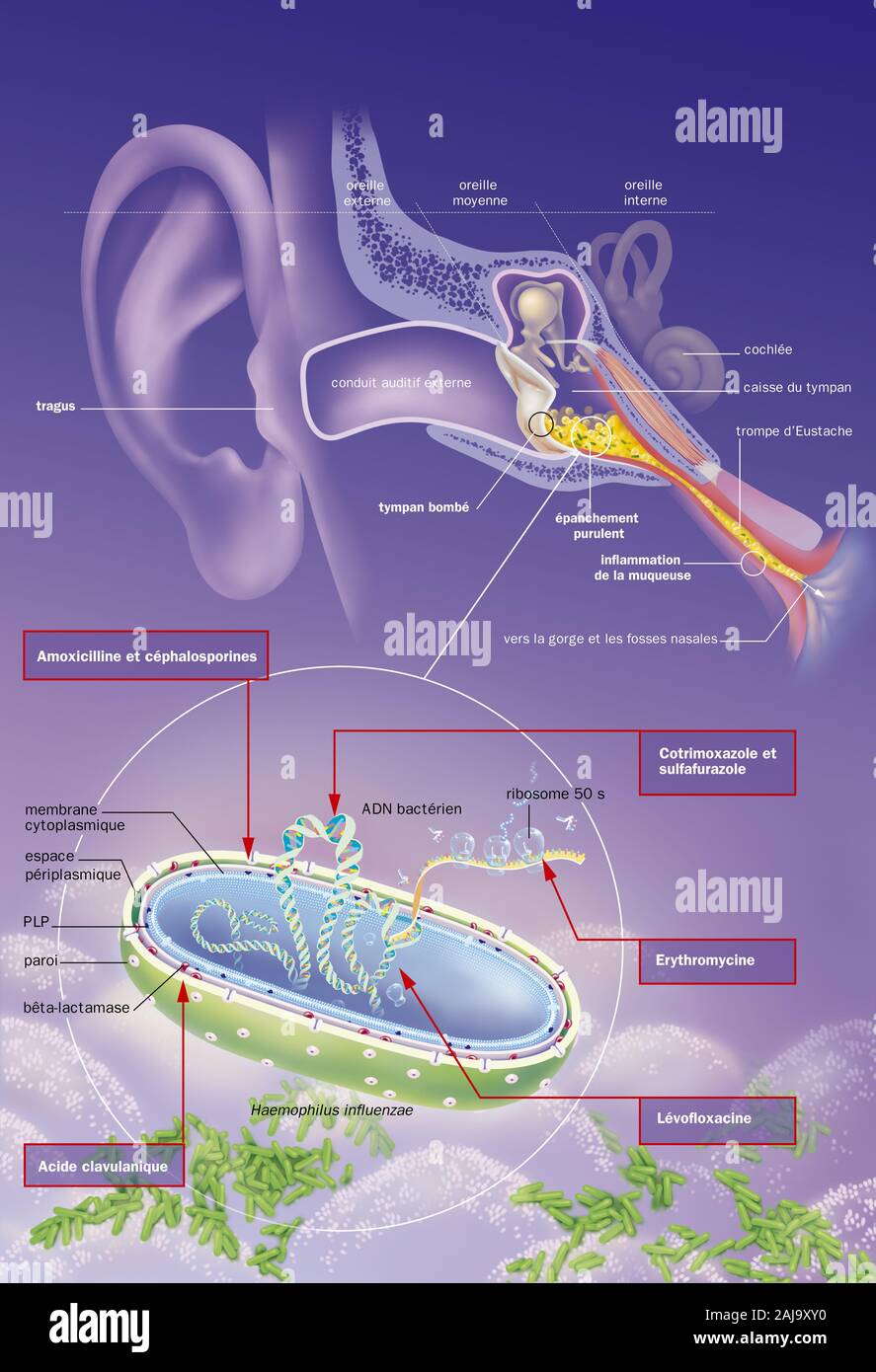 Otitis media eardrum hi-res stock photography and images - Alamy