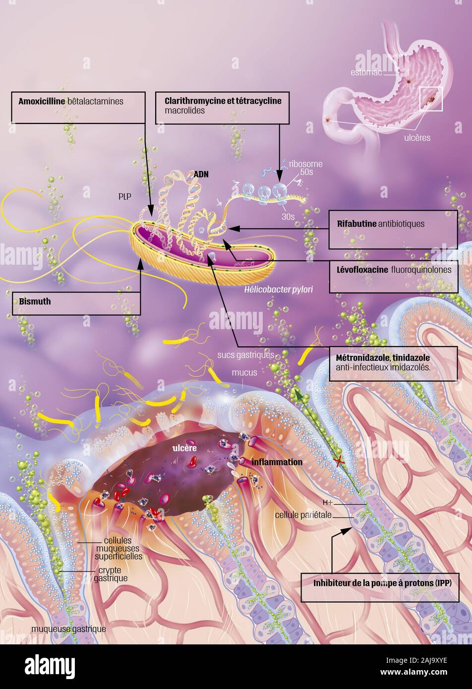Ulcere gastroduodenal and treatment Stock Photo - Alamy