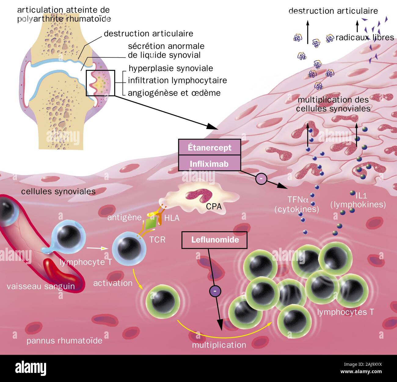 Cytokine arthritis hi-res stock photography and images - Alamy