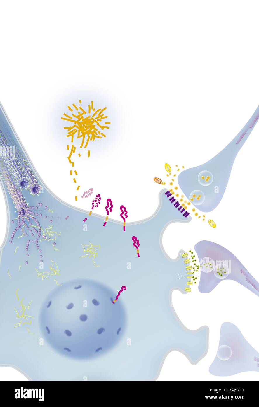Neurofibrillary tangle hi-res stock photography and images - Alamy