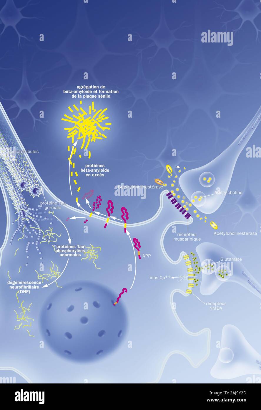Neurofibrillary tangle hi-res stock photography and images - Alamy