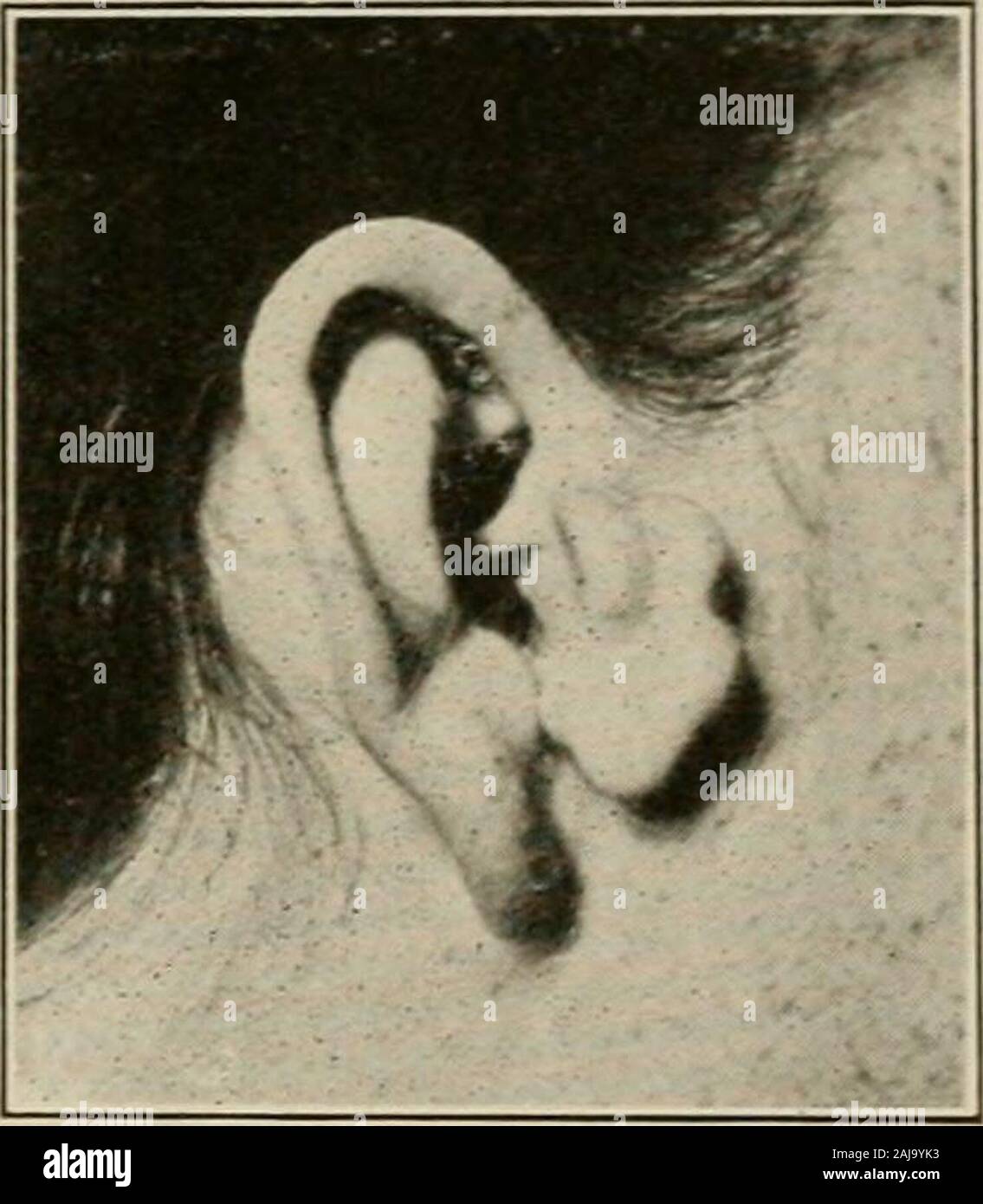 Curled appendage hi-res stock photography and images - Alamy