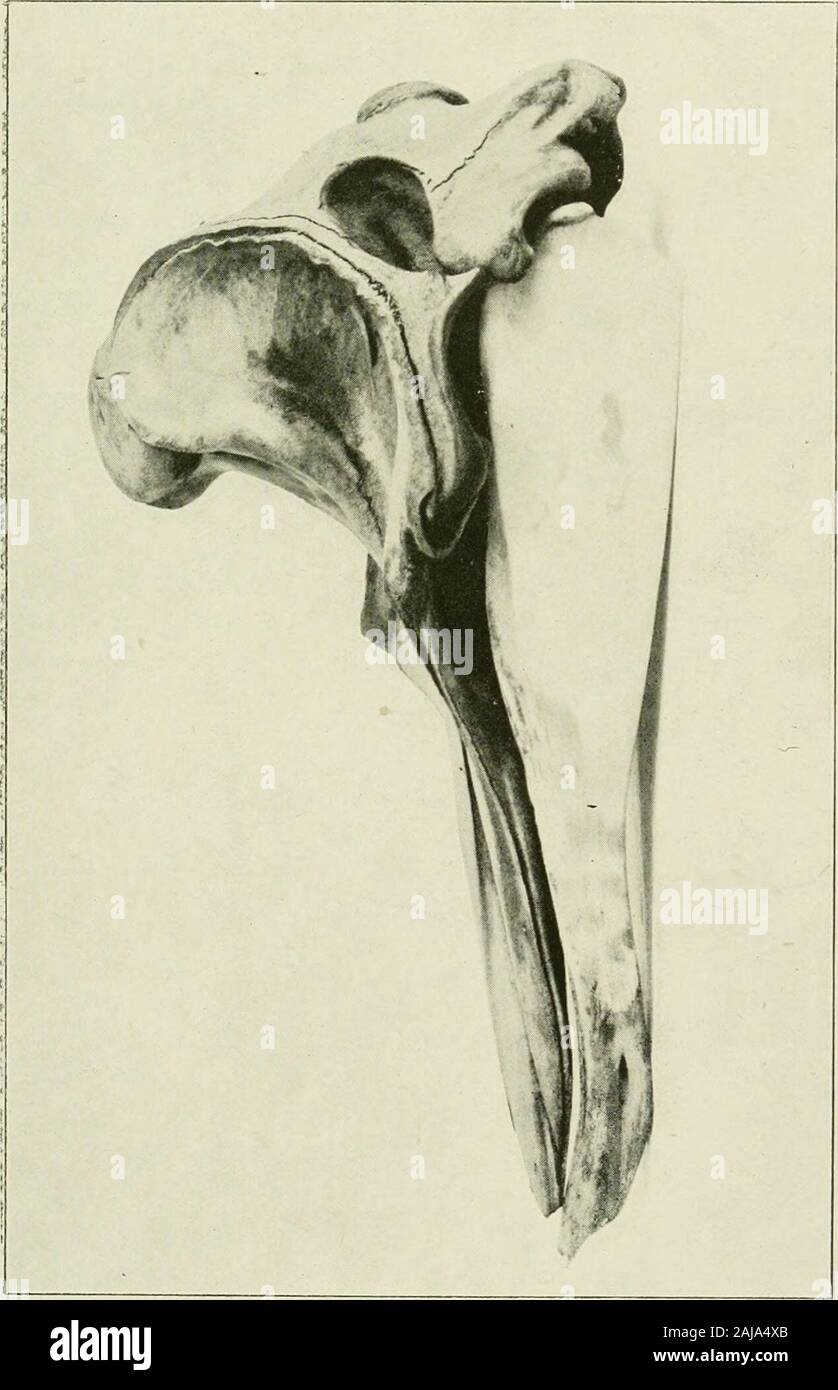 Anterior arch of atlas hi-res stock photography and images - Alamy