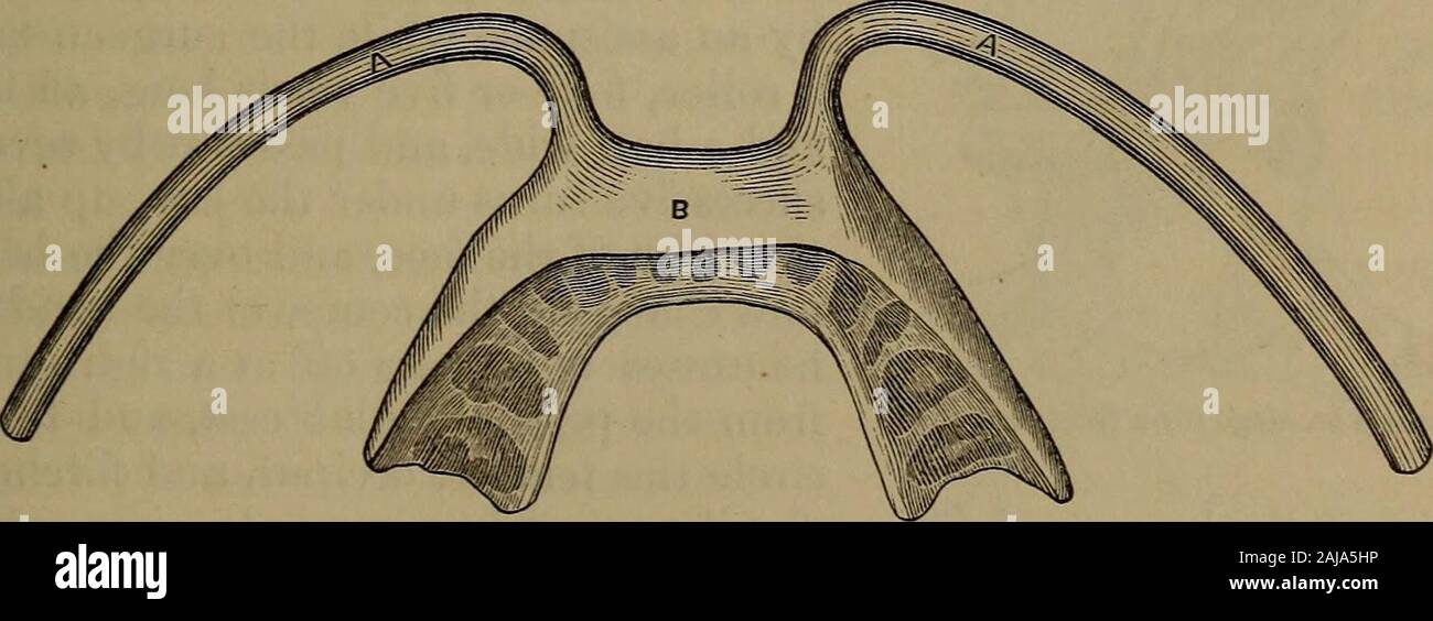 A practical treatise on fractures and dislocations . Plaster model of ...