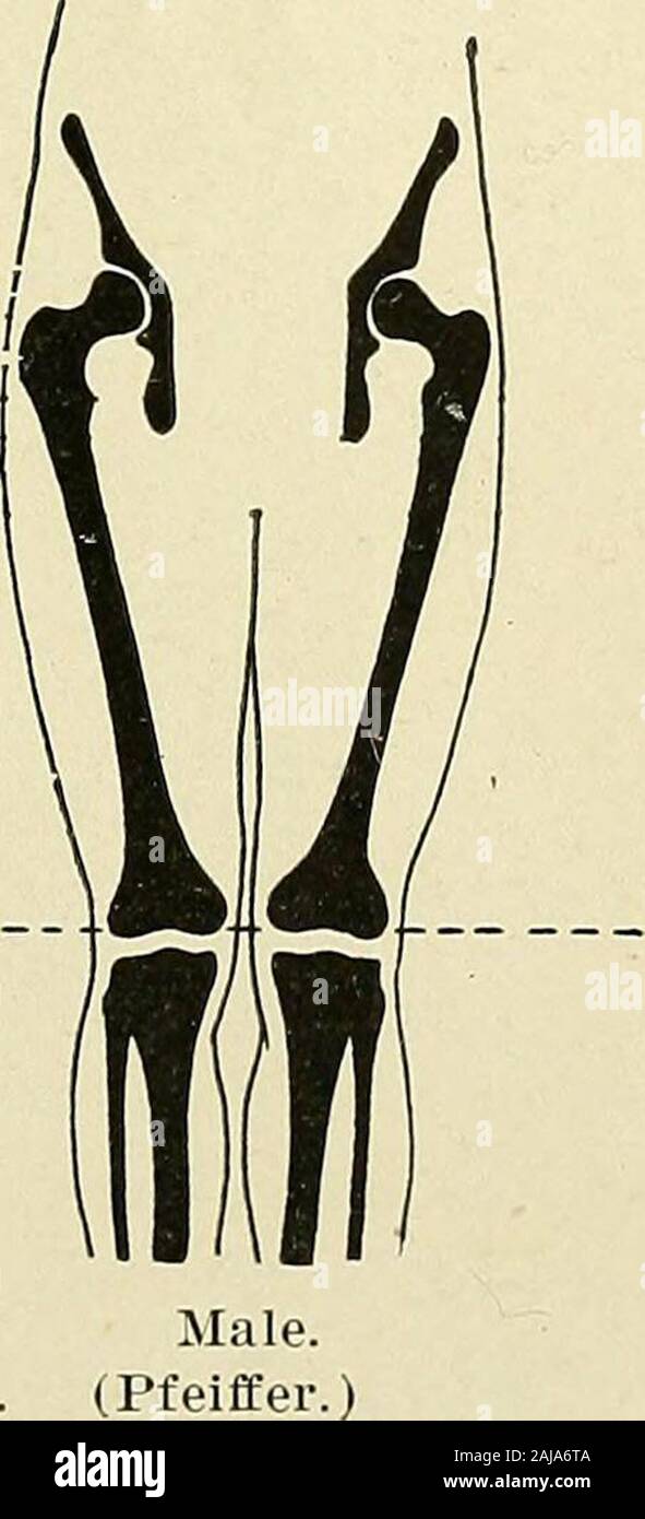 Normal female pelvis hi-res stock photography and images - Alamy