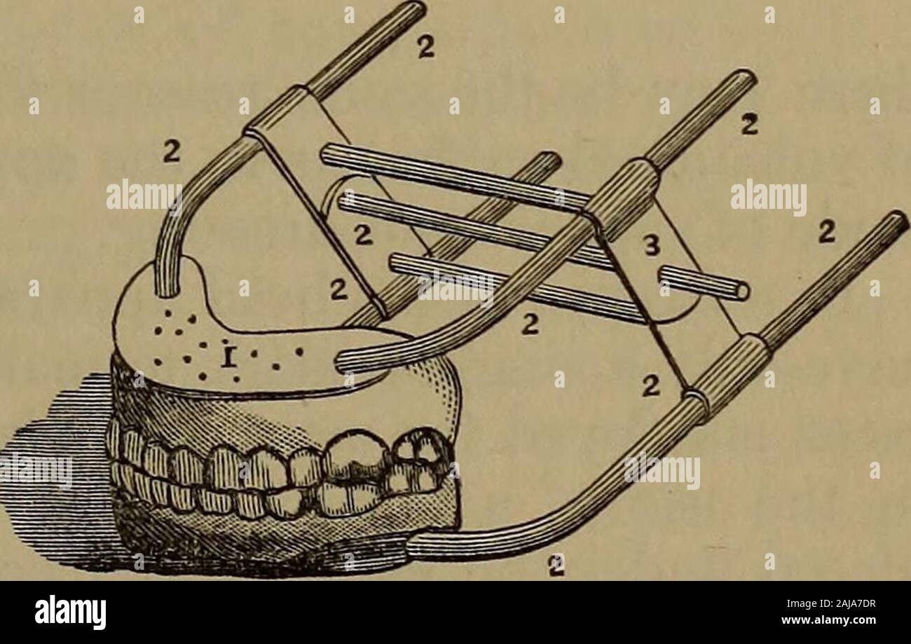 Jaw hinge hi-res stock photography and images - Alamy
