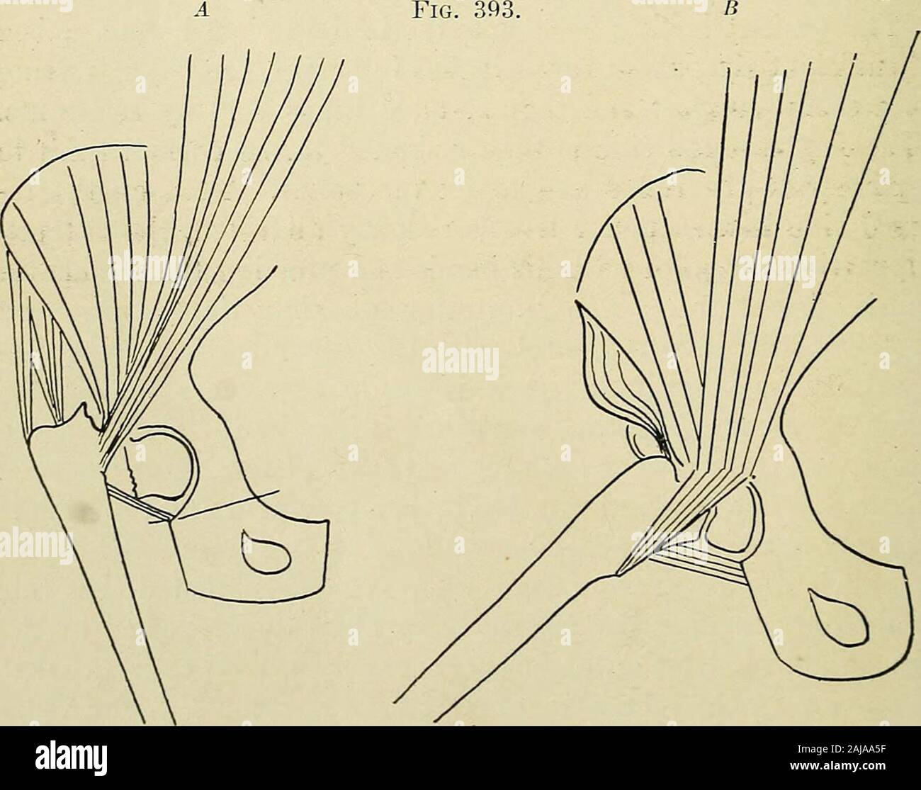 A treatise on orthopedic surgery . The abduction treatment of fracture ...