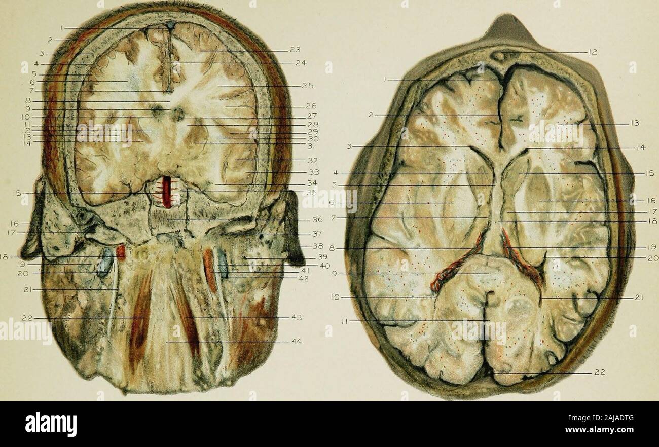 Tentorium cerebelli hi-res stock photography and images - Alamy