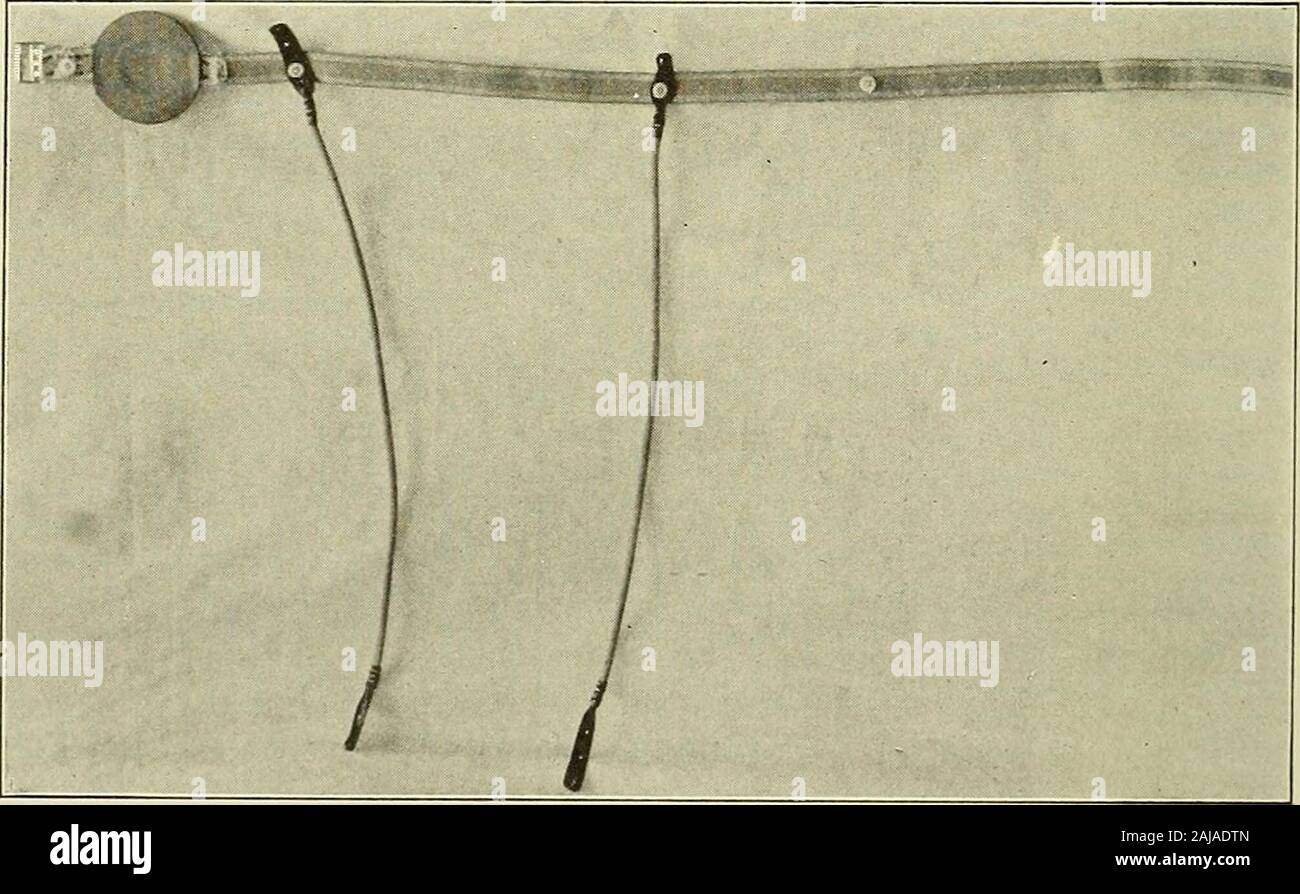 Perineal body hi-res stock photography and images - Alamy