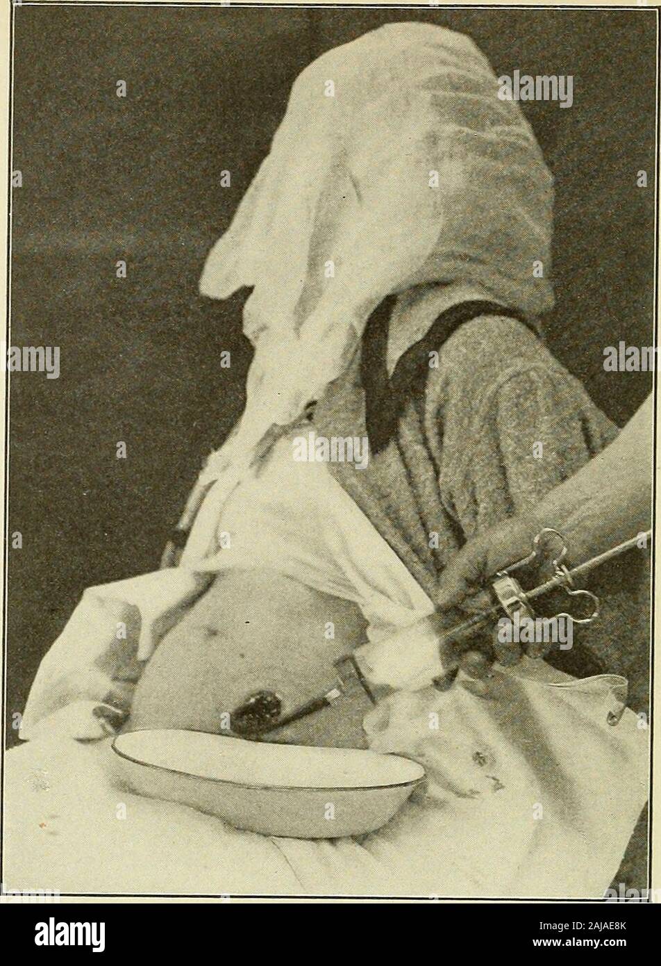 Preparatory and after treatment in operative cases . Fig. 314.—Emptying ...