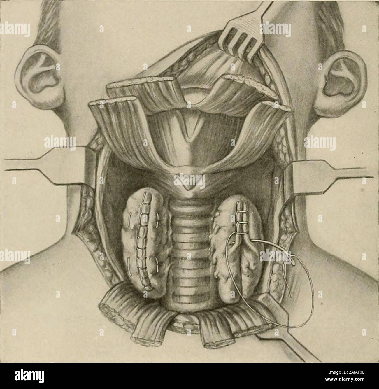 Isthmus of thyroid gland hi-res stock photography and images - Alamy