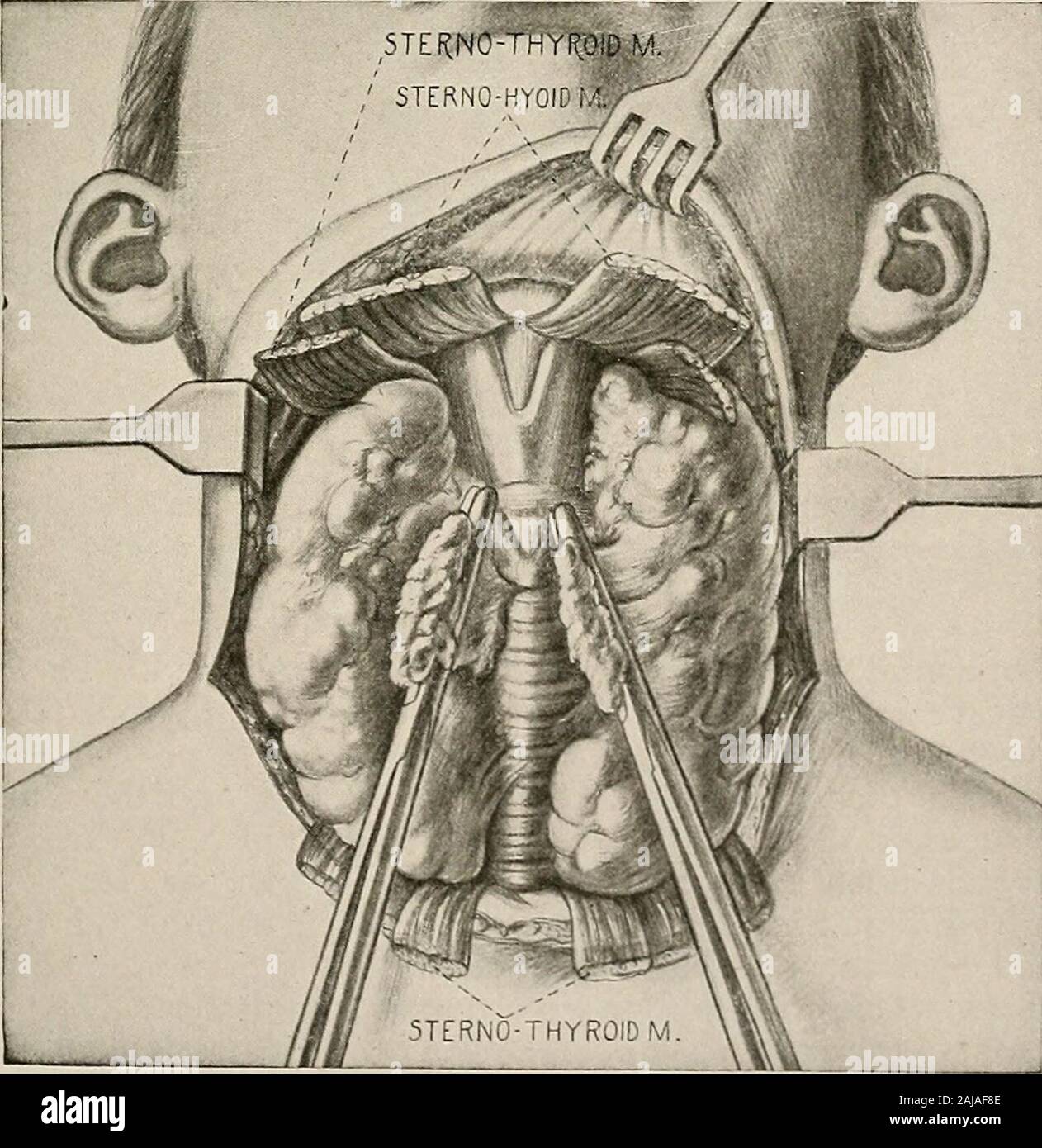 Isthmus of thyroid gland hi-res stock photography and images - Alamy