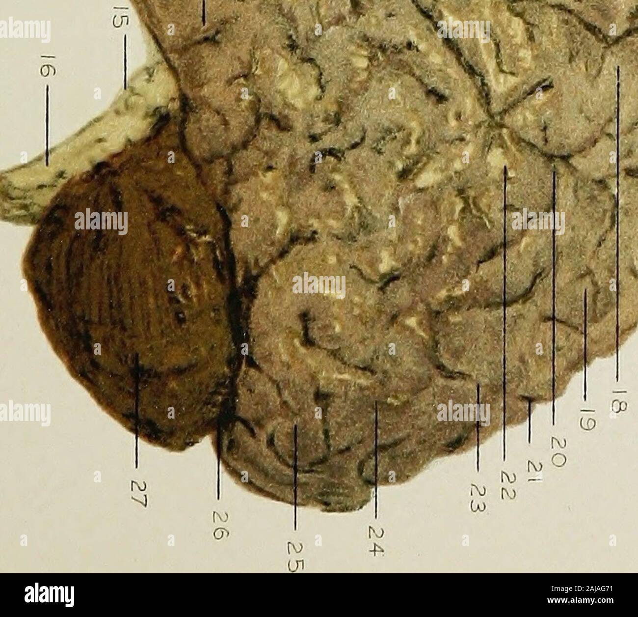 Cortical plate hi-res stock photography and images - Alamy