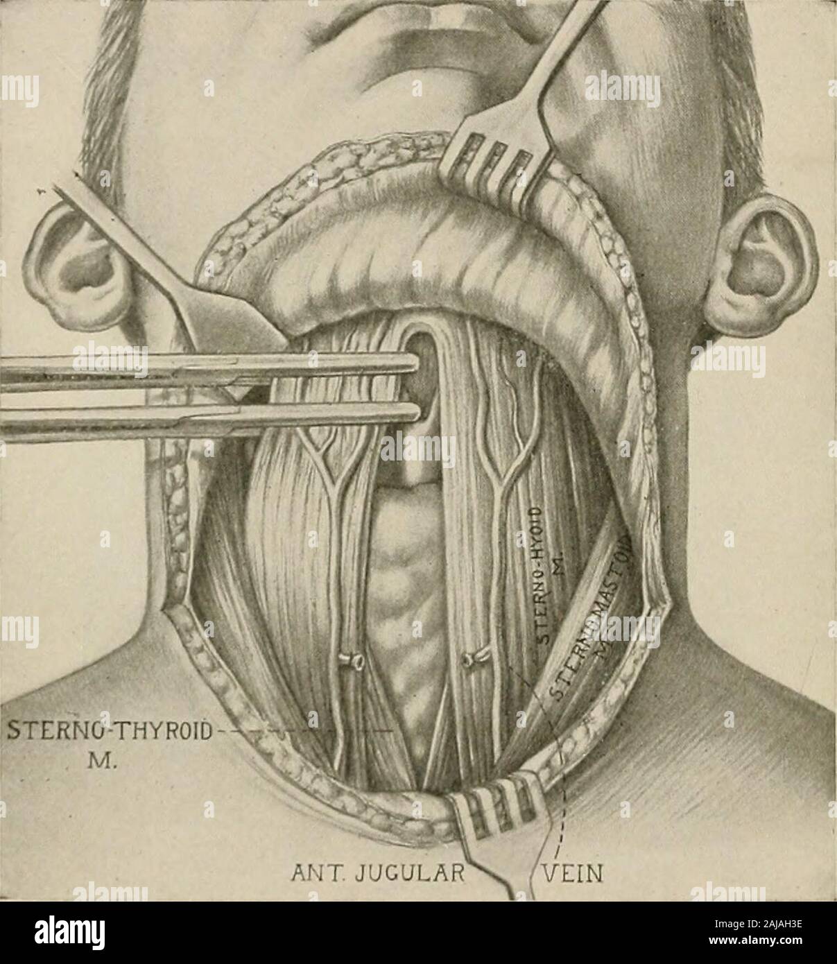 Isthmus Of Thyroid