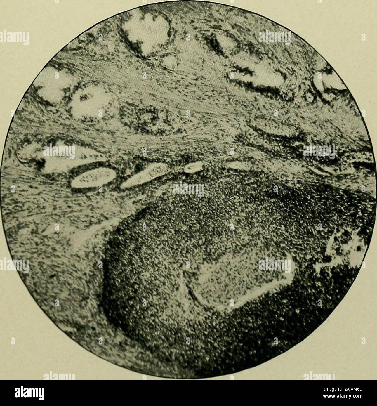 Medical and surgical reports . Fig. 9. Showing round-cell infiltration ...