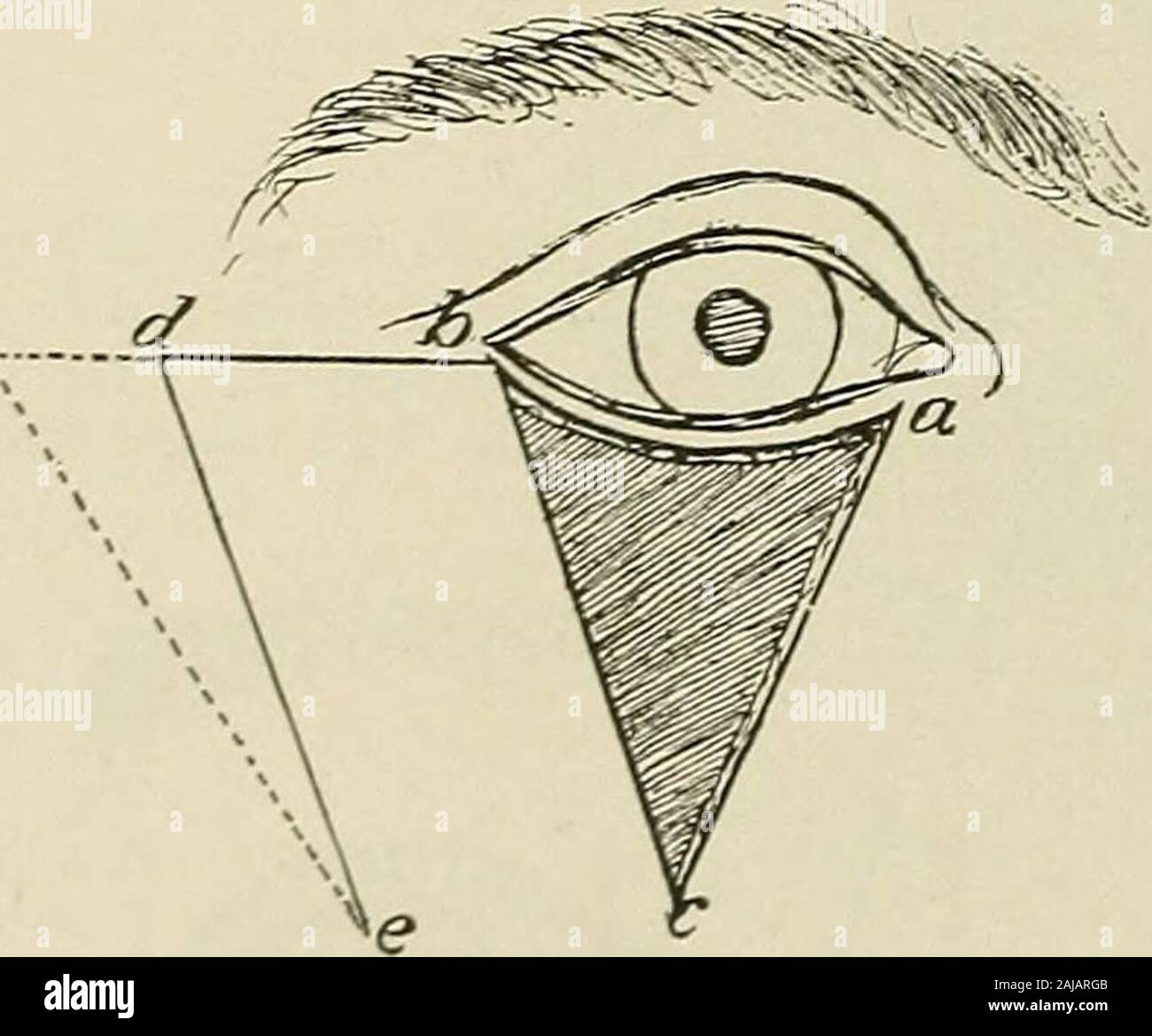 Plastic surgery; its principles and practice . Fig. 343.—Trucs ...