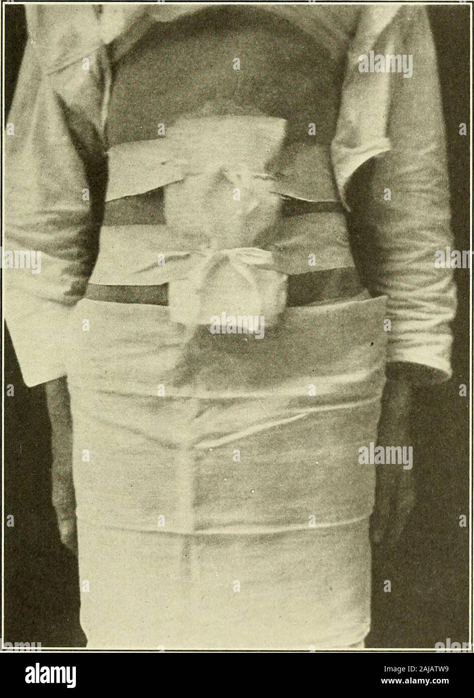 Wound secretion hi-res stock photography and images - Alamy