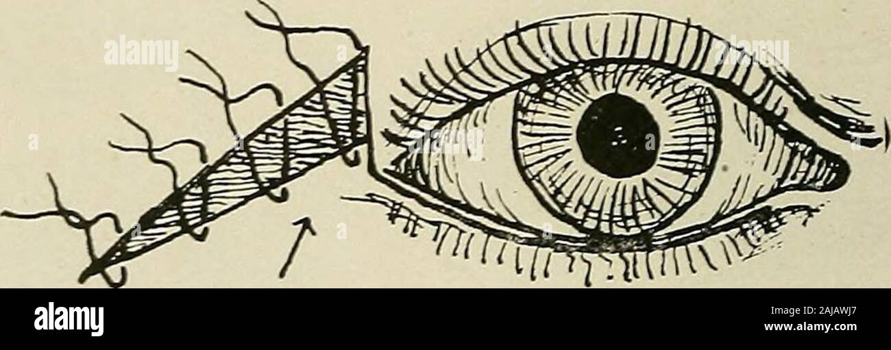 Outer canthus hi-res stock photography and images - Alamy