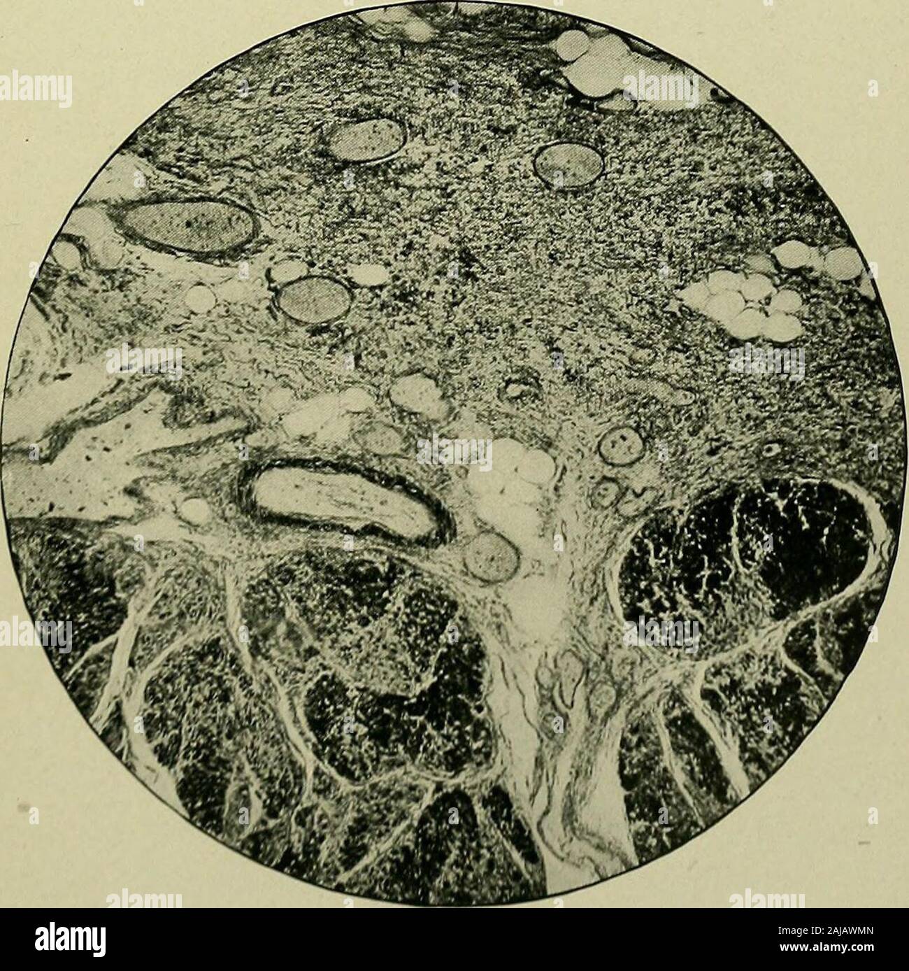 Medical and surgical reports . Fig. 1. Sagittal section of senile ...