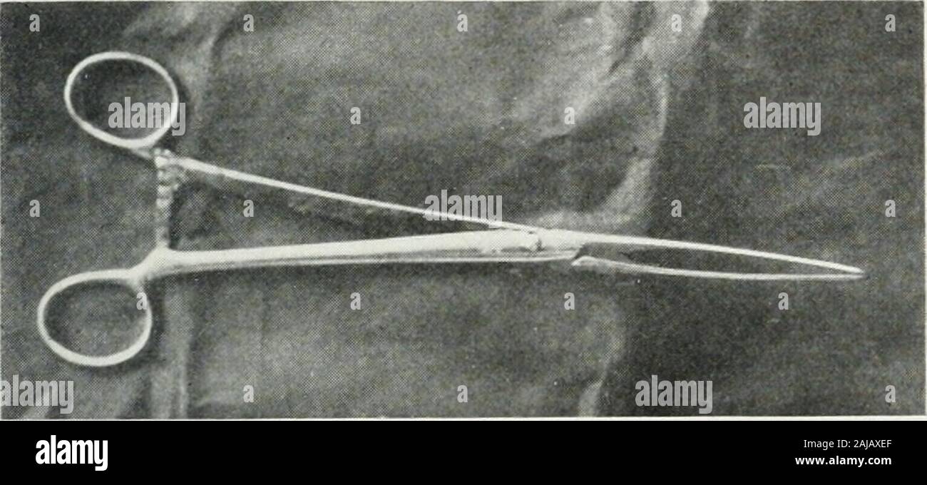 Annals of surgery . complete) cut in theartery. Method of Suturing a ...