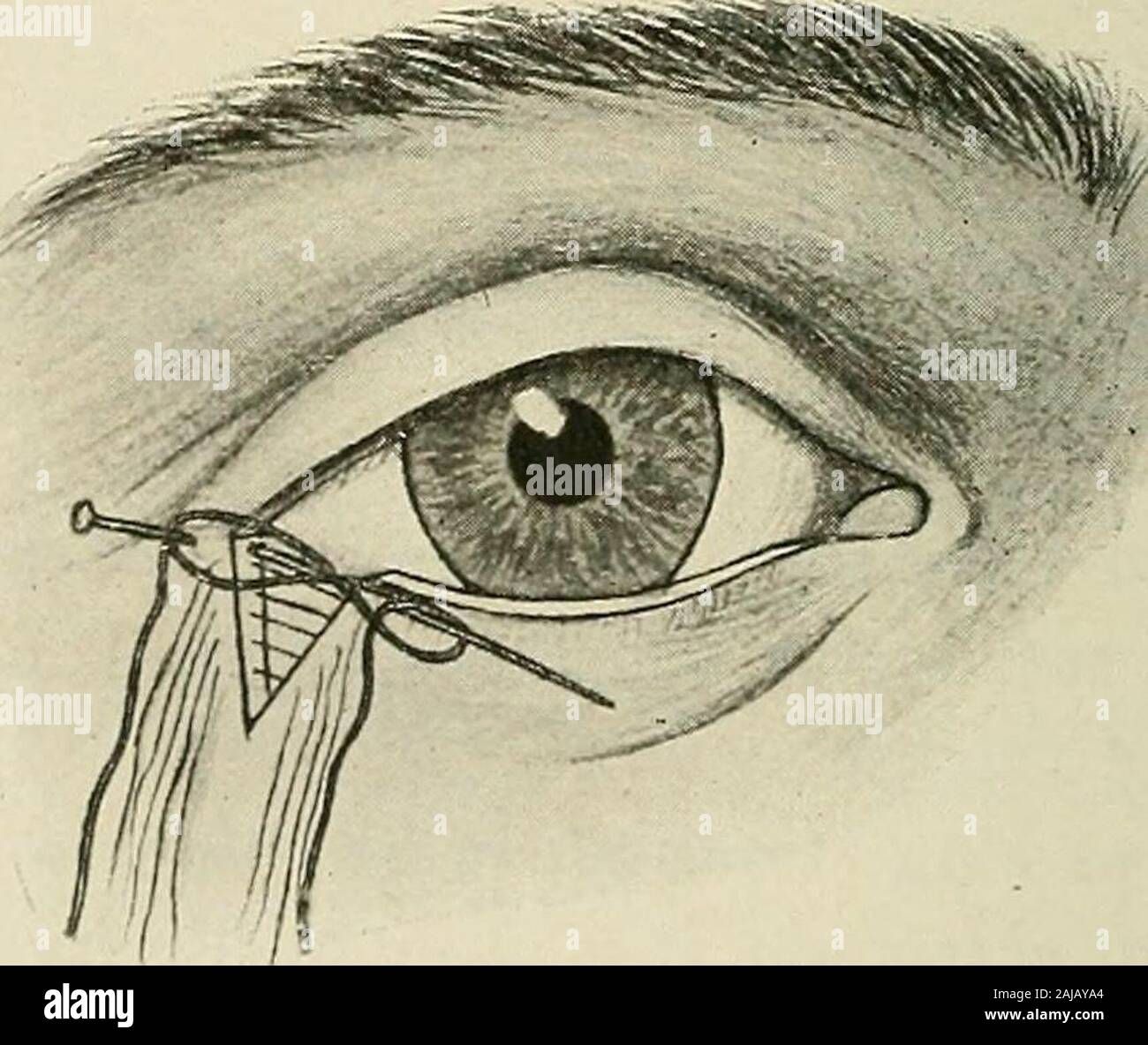 Beard flap of skin hi-res stock photography and images - Alamy