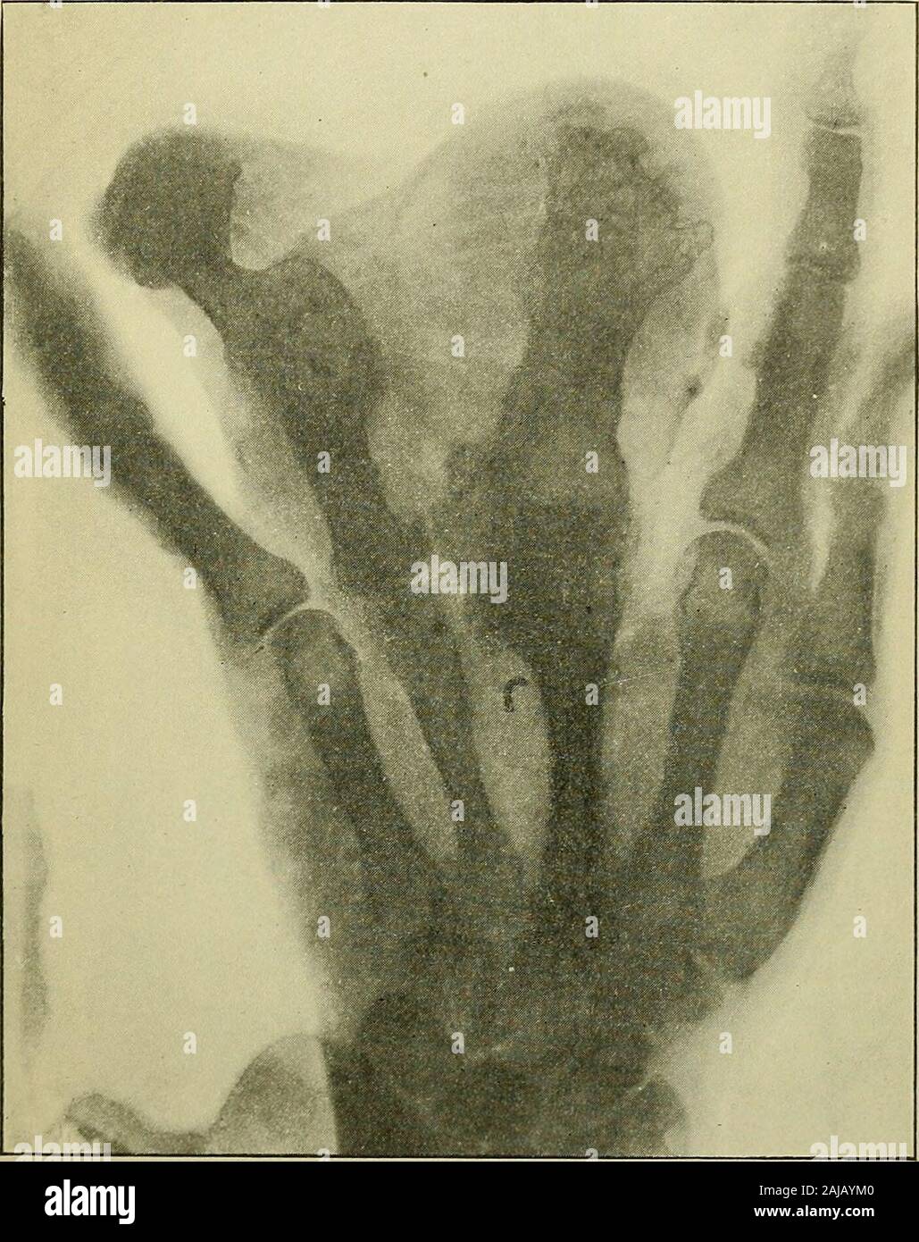 Medical and surgical reports . FIGURE 10. flaps with which to cover the ...
