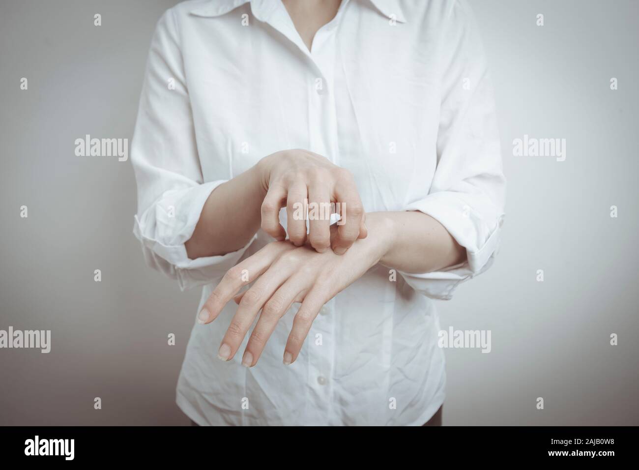 Signs of dermatitis and scabies. Woman scratches her hands. Skin ...