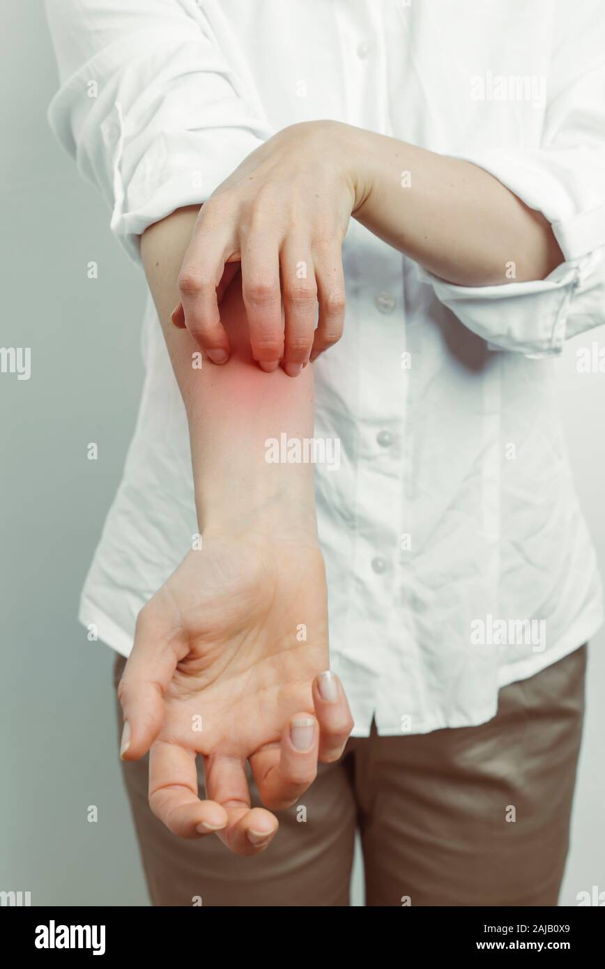 Signs of dermatitis and scabies. Woman scratches her hands. Skin ...