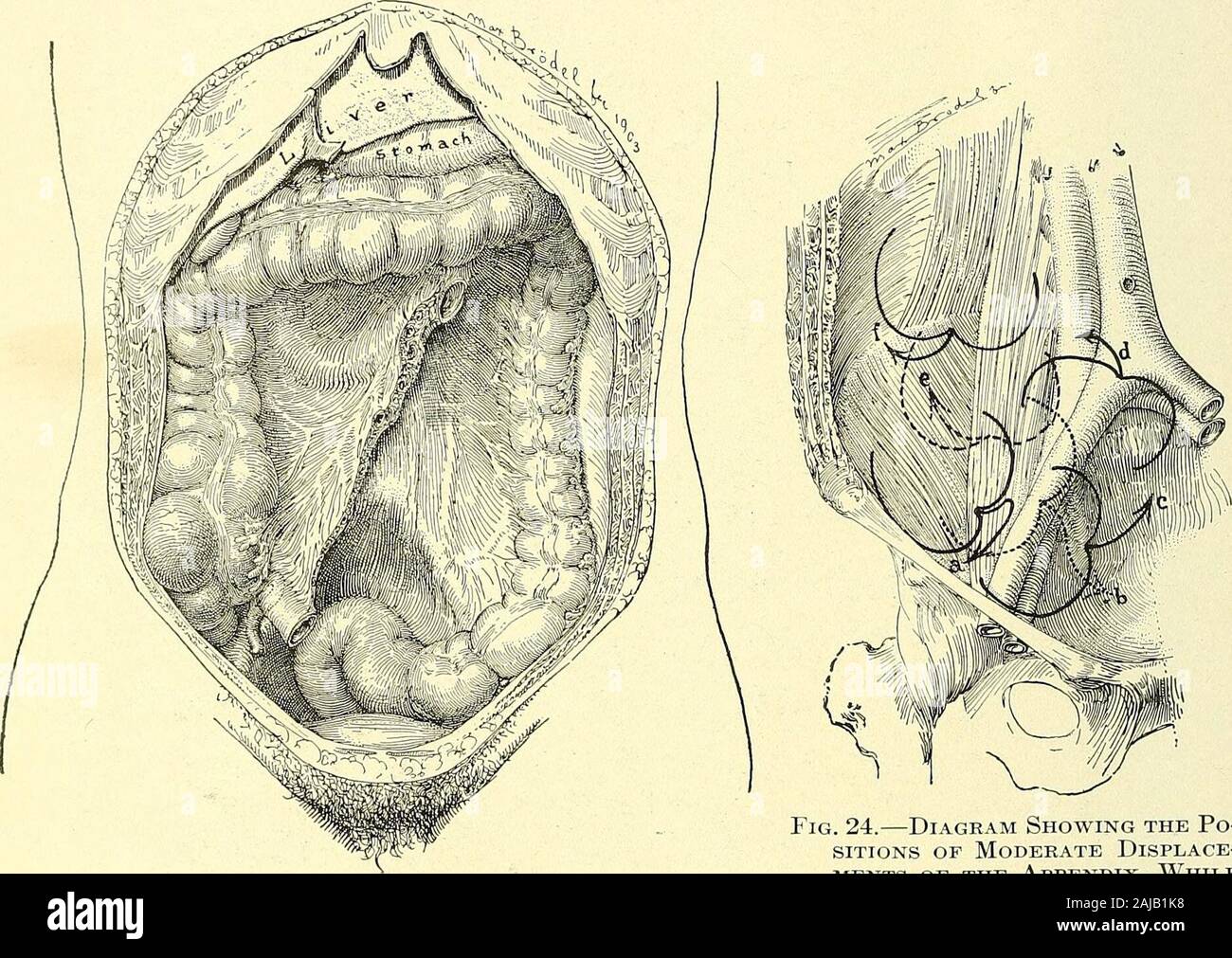 Operative gynecology : . the Various Groups of the Small Intestine ...