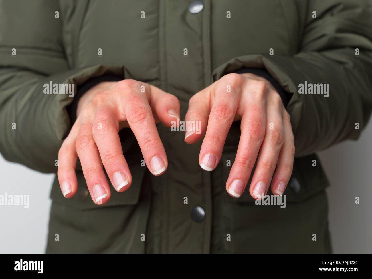 Frozen woman's hands in winter Stock Photo - Alamy