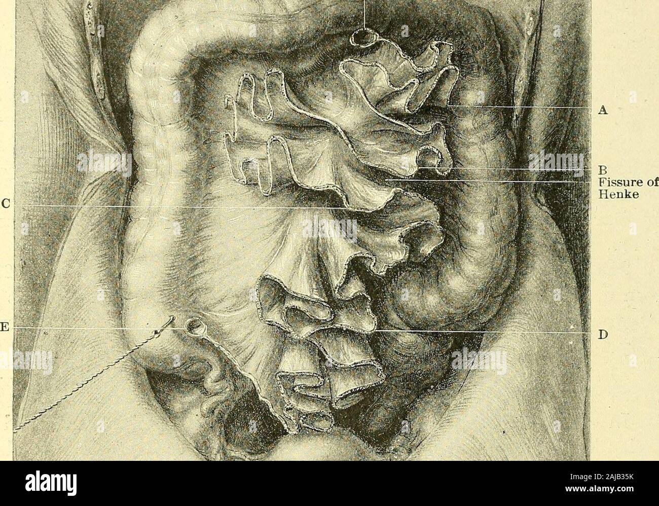 Iliac fossa hi-res stock photography and images - Alamy