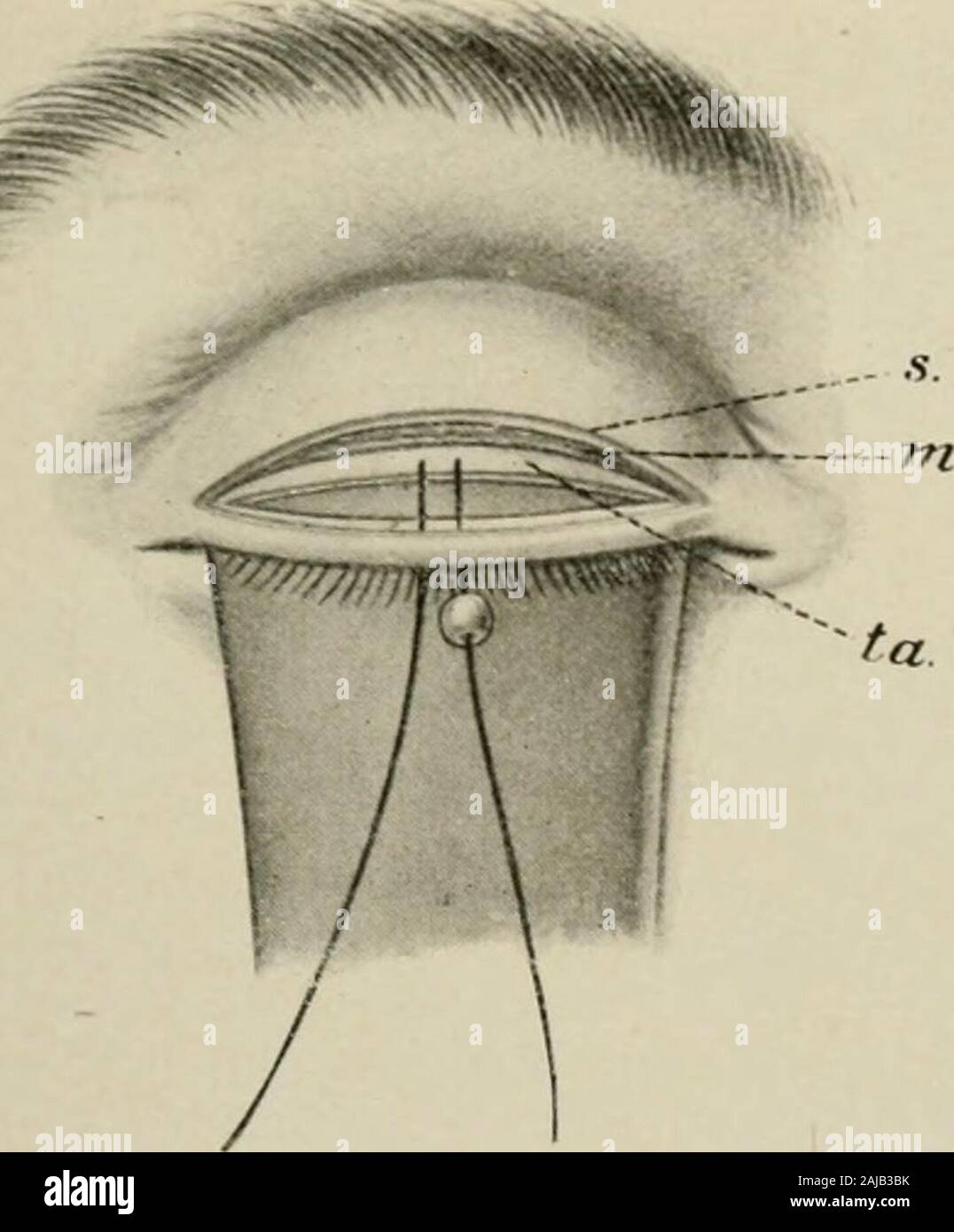 Plastic surgery; its principles and practice . Fig. 325. Fig. 326. Pig ...