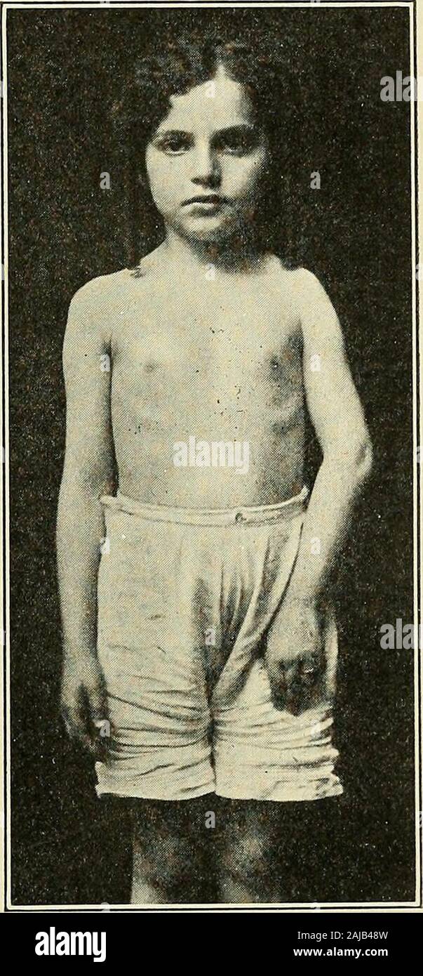 Arm adduction hi-res stock photography and images - Alamy