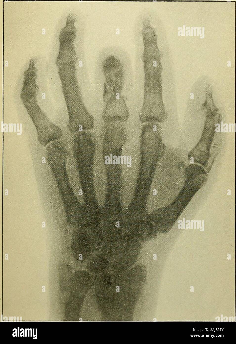 Pentadactyl hi-res stock photography and images - Alamy