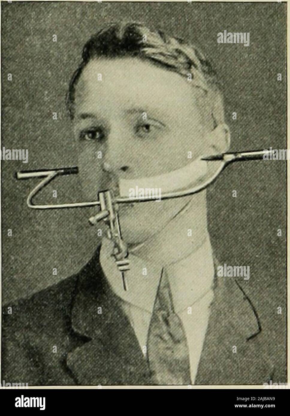 Super fossa hi-res stock photography and images - Alamy