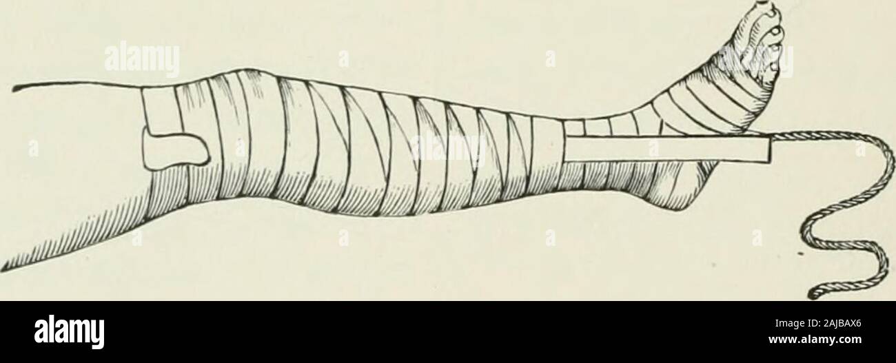 Tissue adhesive plaster hi-res stock photography and images - Alamy