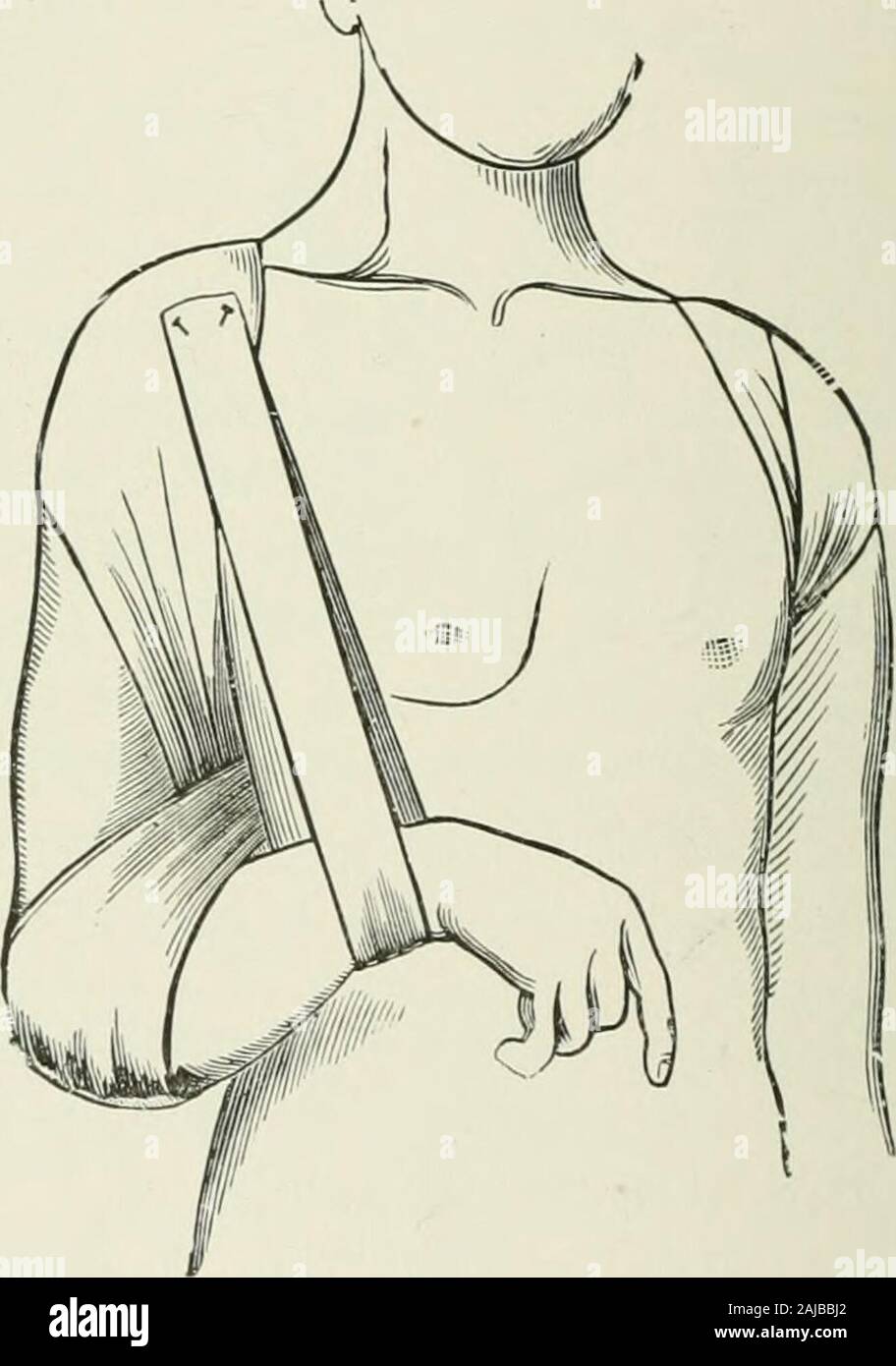 Elbow incision hi-res stock photography and images - Alamy