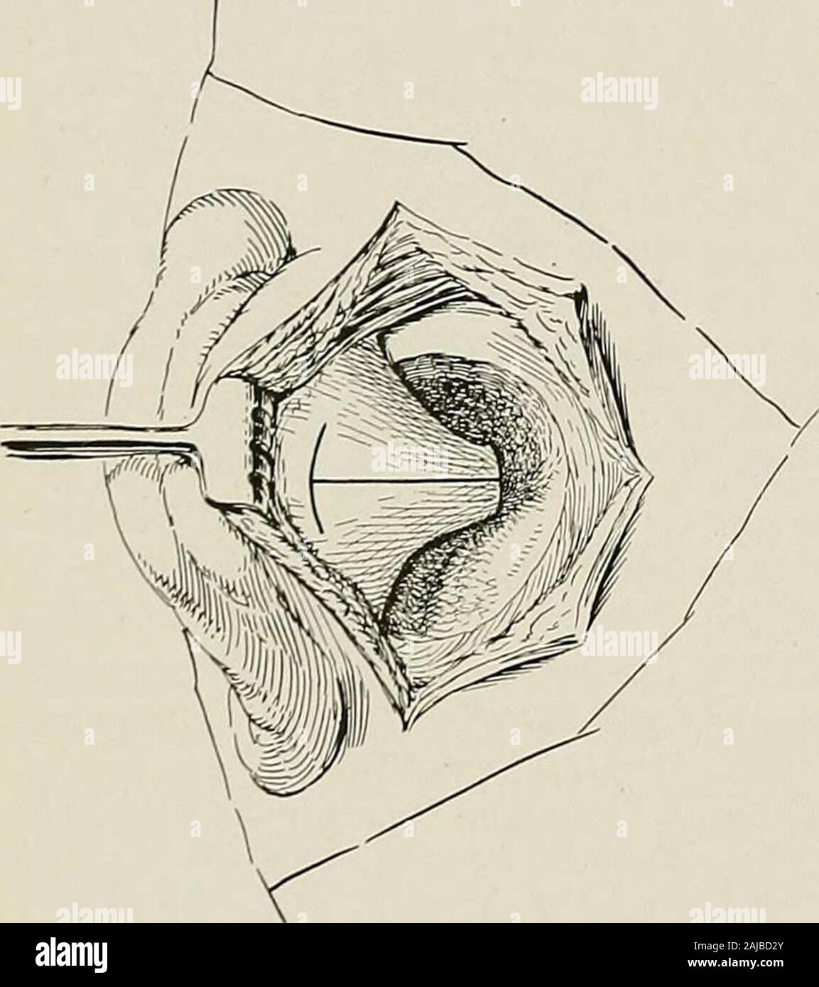 Surgical treatment; a practical treatise on the therapy of surgical ...