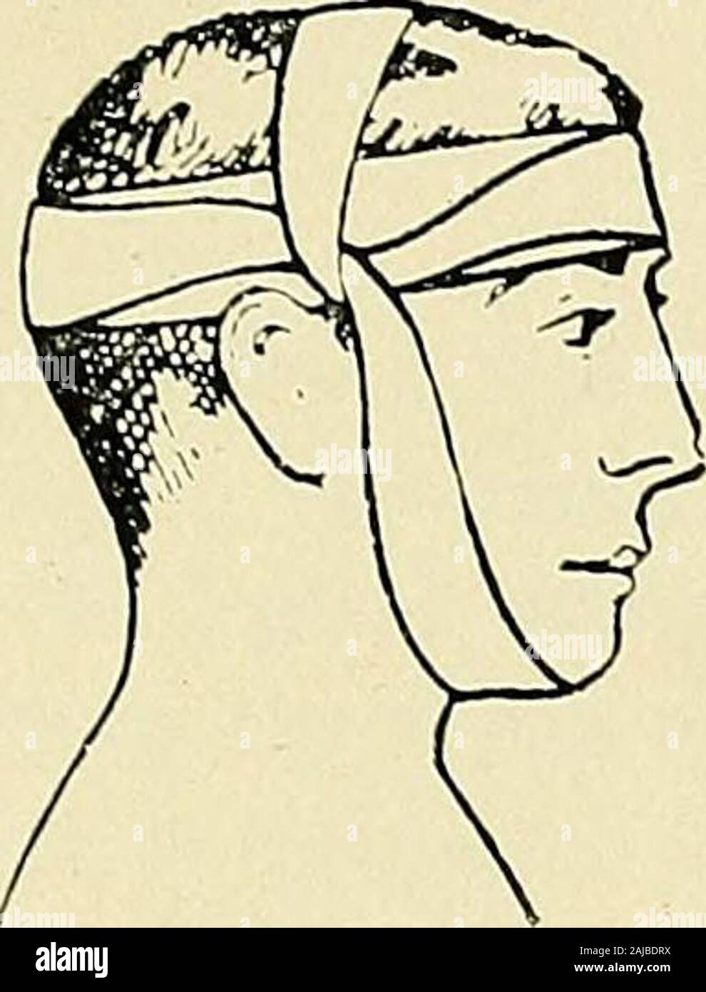 The principles and practice of bandaging : by Gwilym G Davis . angle of ...