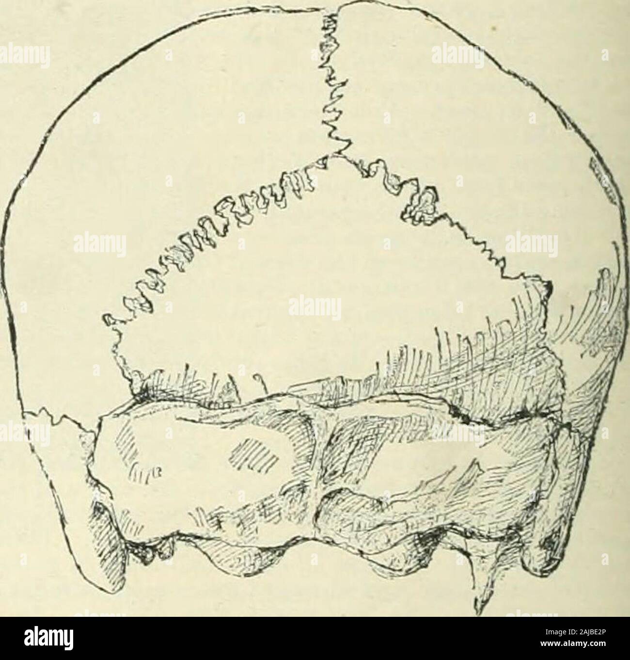 Wormian bone hi-res stock photography and images - Alamy