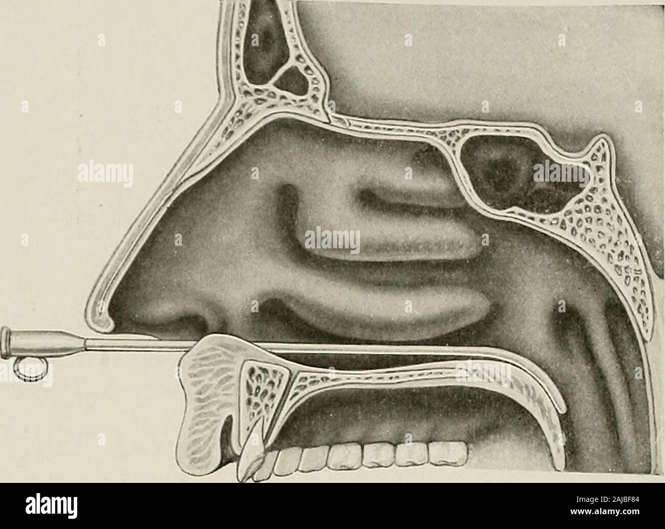 Surgical treatment; a practical treatise on the therapy of surgical ...