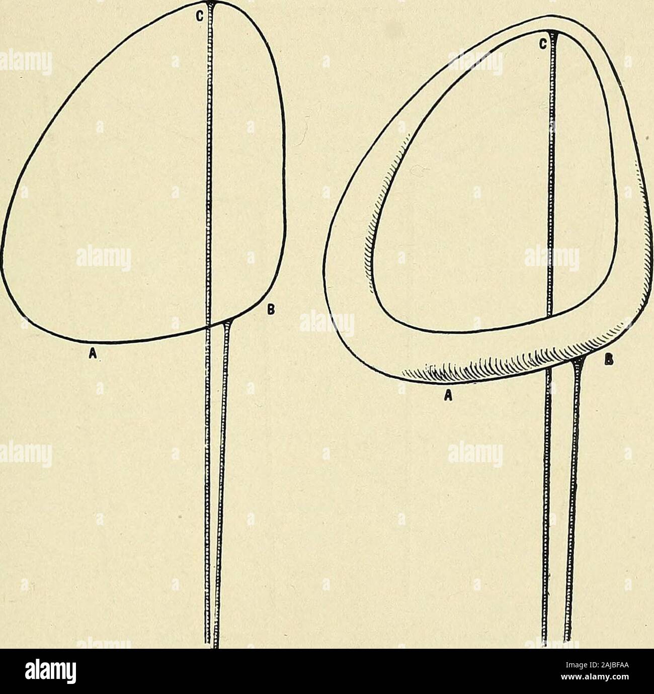 A treatise on orthopedic surgery . deformity and subluxation at theknee ...