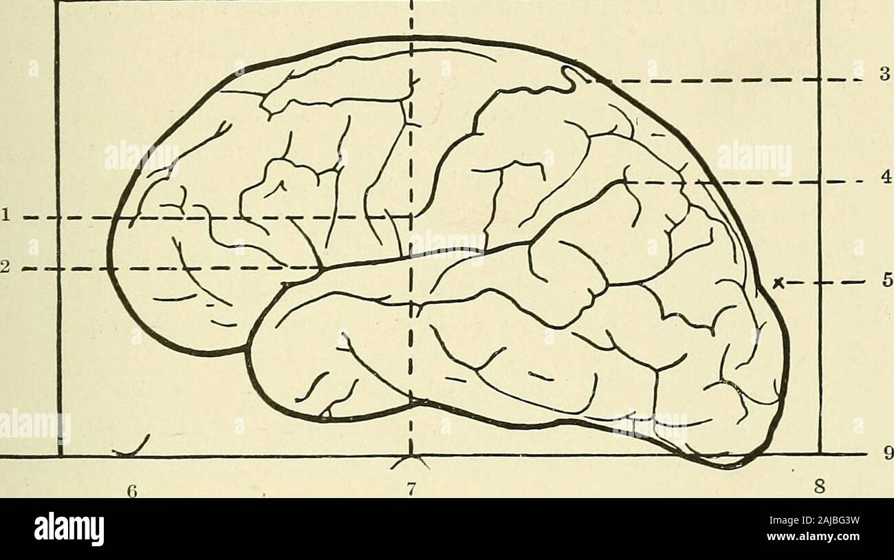 Calvarium hi-res stock photography and images - Alamy